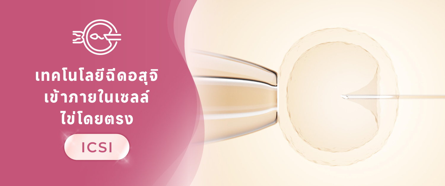 ICSI การทำ อิ๊กซี่ - ศูนย์การแพทย์ให้คำปรึกษา และรักษาผู้มีบุตรยาก ...